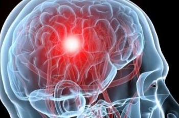Cerebrovascular Diseases